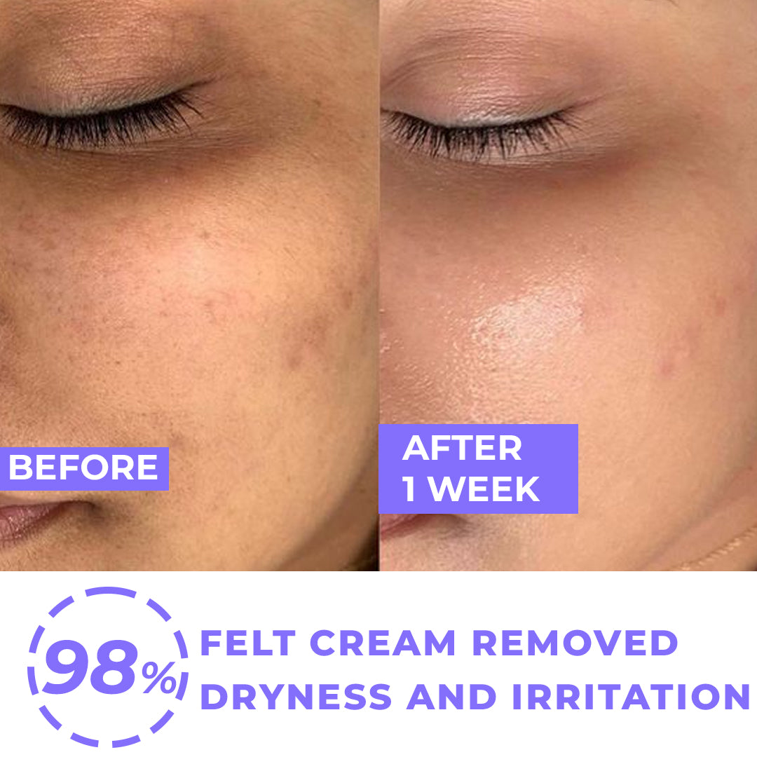 Best Day Cream For Oily & Dry Skin